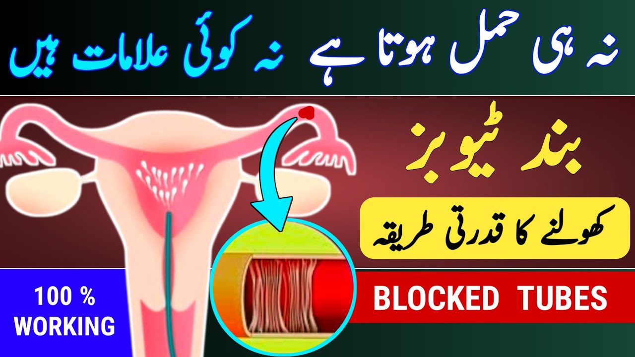 How To Open Blocked Tubes Naturally |Block Fallopian Tube Treatment ...