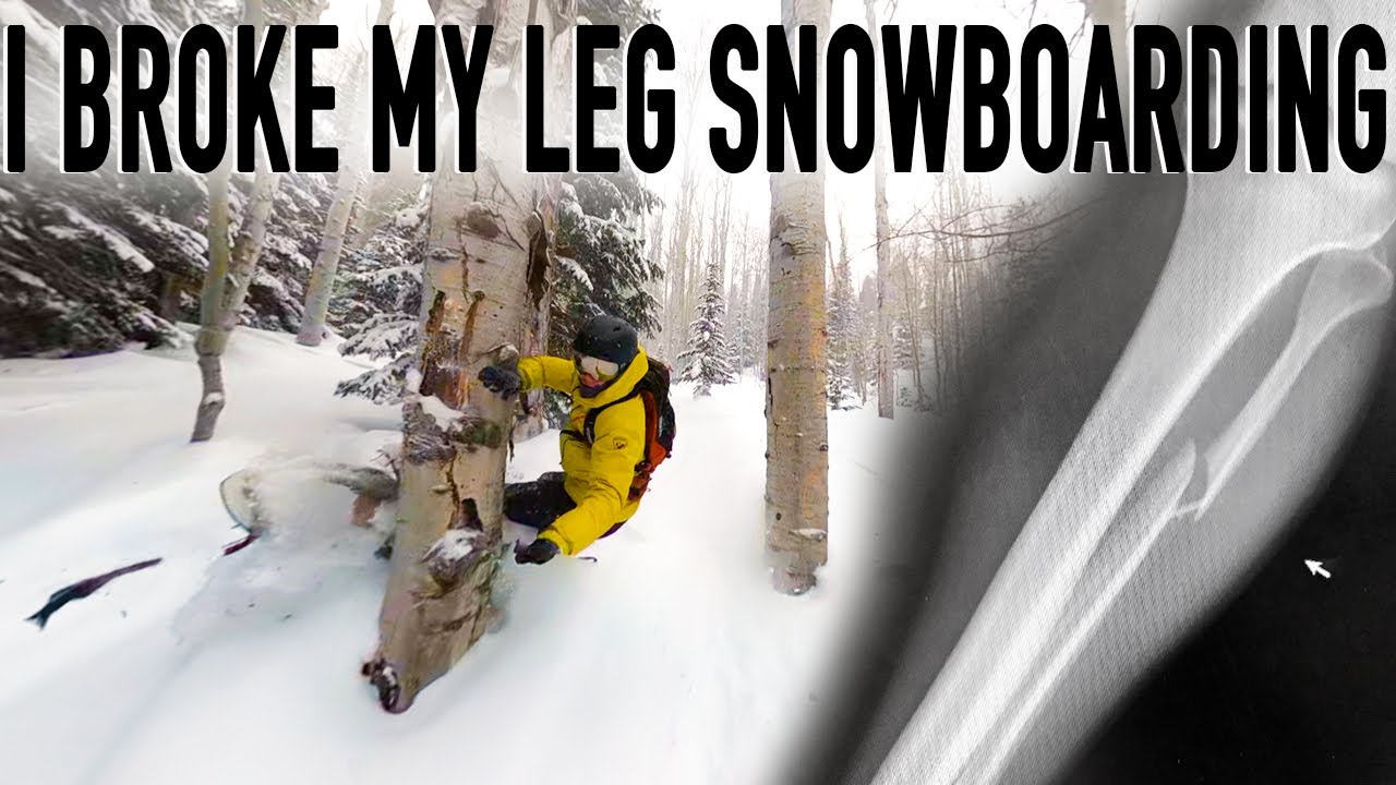 Snowboarder Hits Tree, Breaks leg, and Self Evacs. GoPro MAX - YouTube