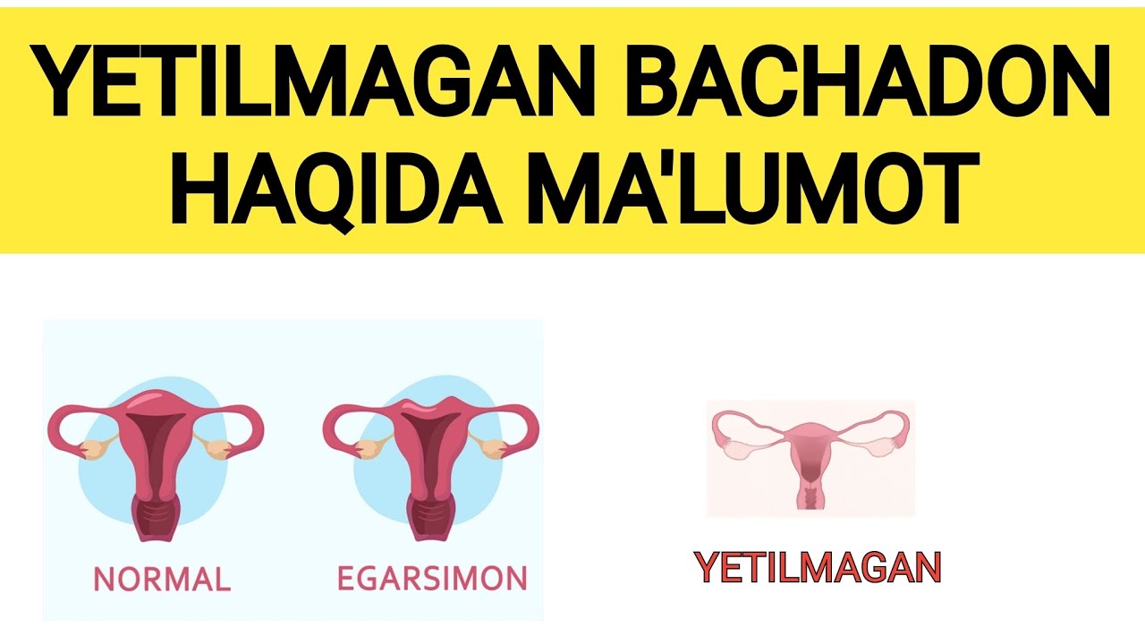 YETILMAGAN BACHADON HAQIDA MA'LUMOT. SHAKLLANMAGAN BACHADON HAQIDA MA ...