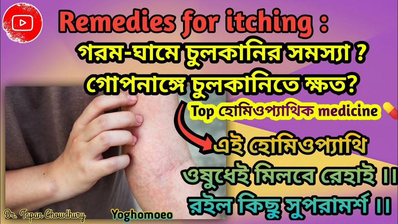 চুলকানি সারানোর হোমিওপ্যাথি ওষুধ । best homeopathic medicine for ...