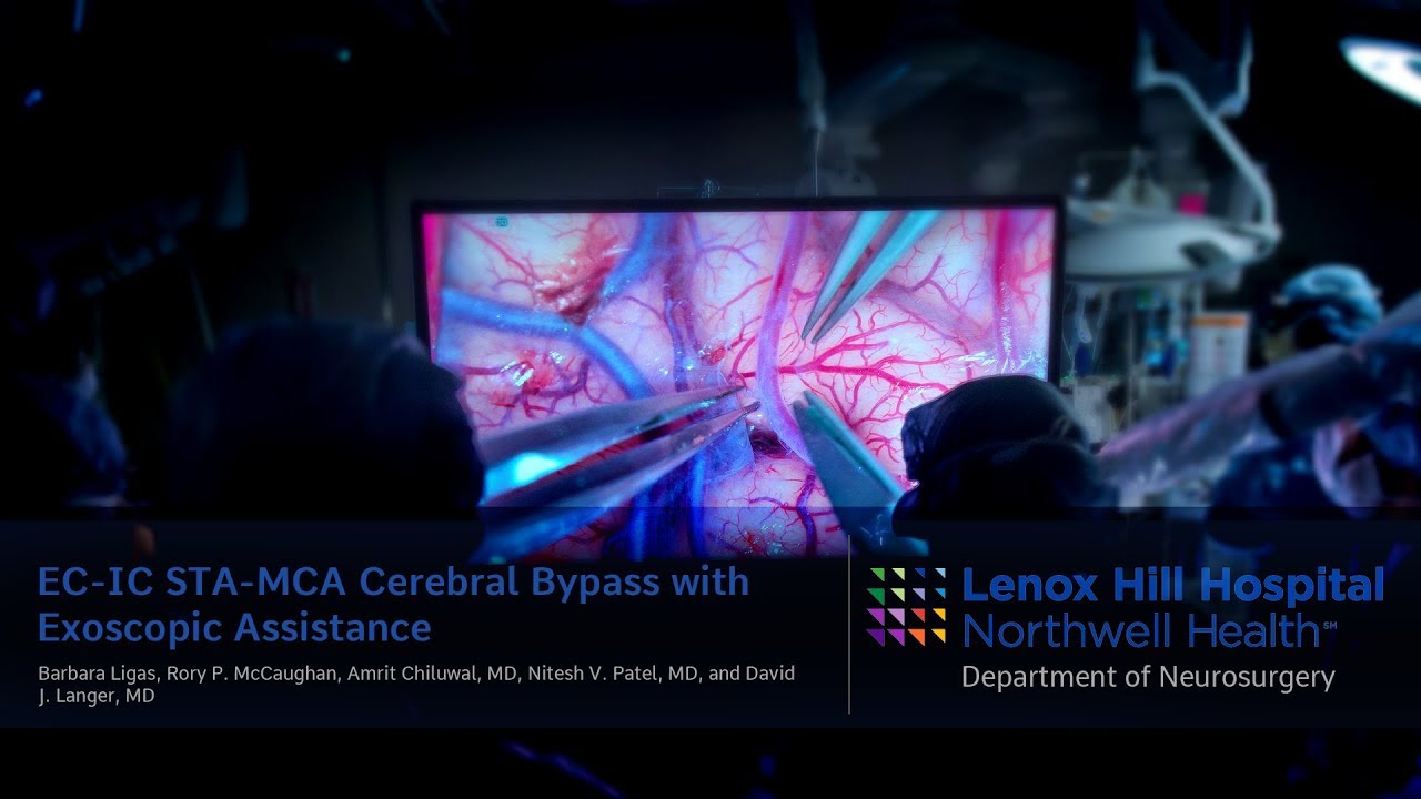 EC-IC STA-MCA Cerebral Bypass - YouTube