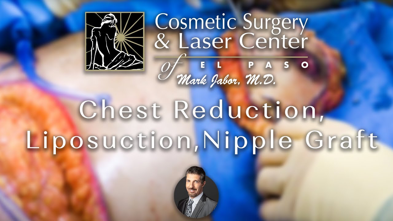 Chest Reduction, Tissue Excision, Liposuction, Nipple Graft | Dr. Jabor ...