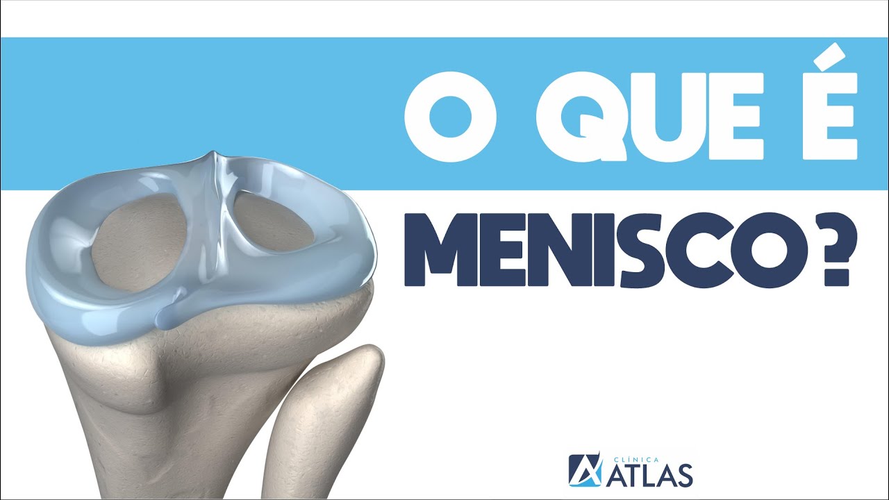 O QUE É O MENISCO? (Clínica Atlas | Dr. Adriano Almeida - Ortopedista ...