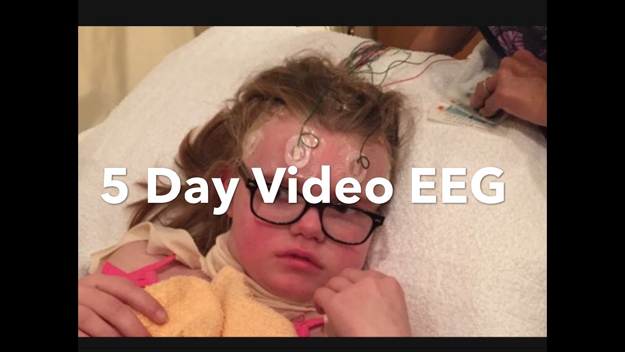5 Day Video EEG - YouTube