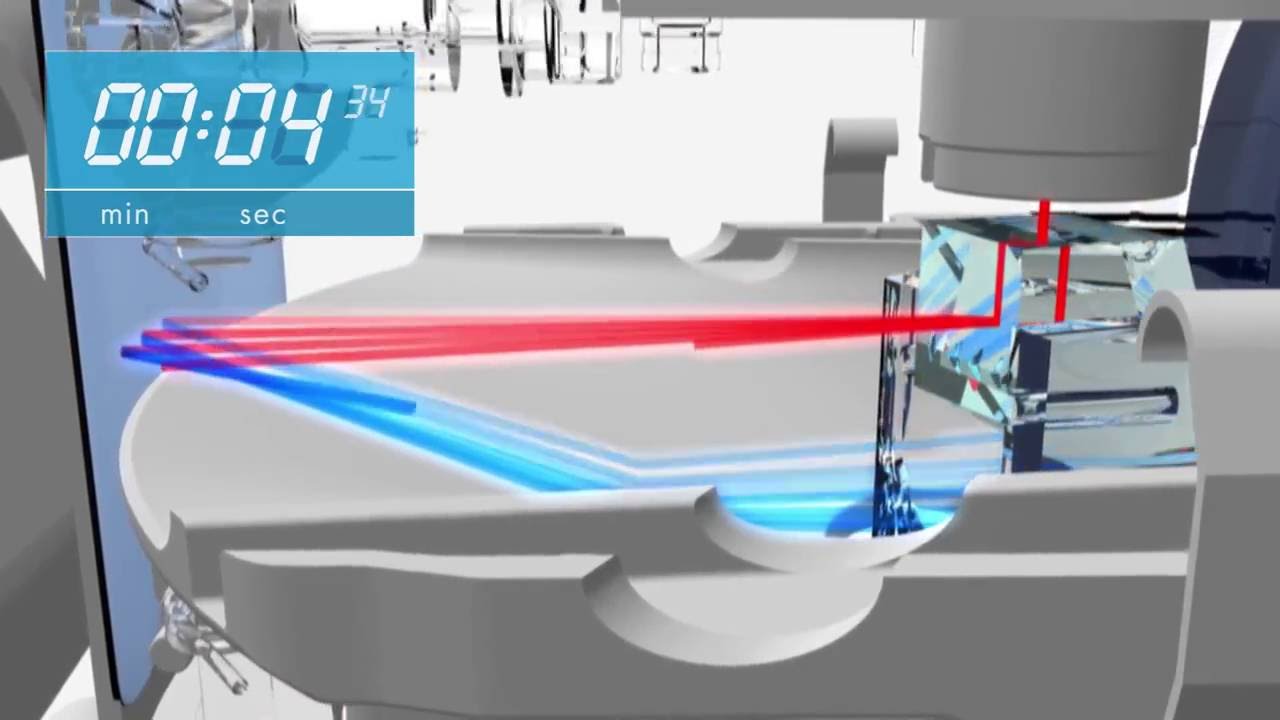 Durr : VistaScan MiniView - YouTube