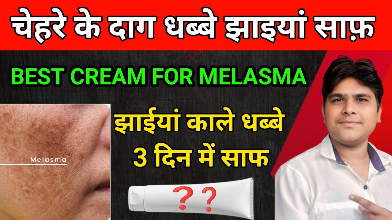 Melasma treatment | Dark circle remove cream | How to remove face black ...