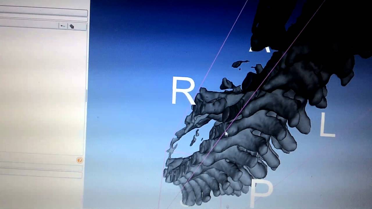 Segmentation & 3D Model Construction using 3D slicer - YouTube