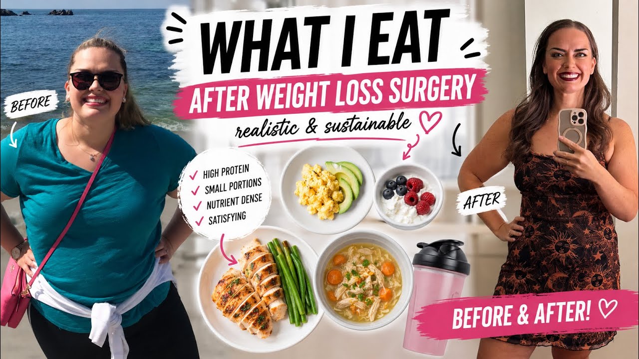 Post Weight Loss Surgery Meals: What I Eat in a Day (20 Months Later ...