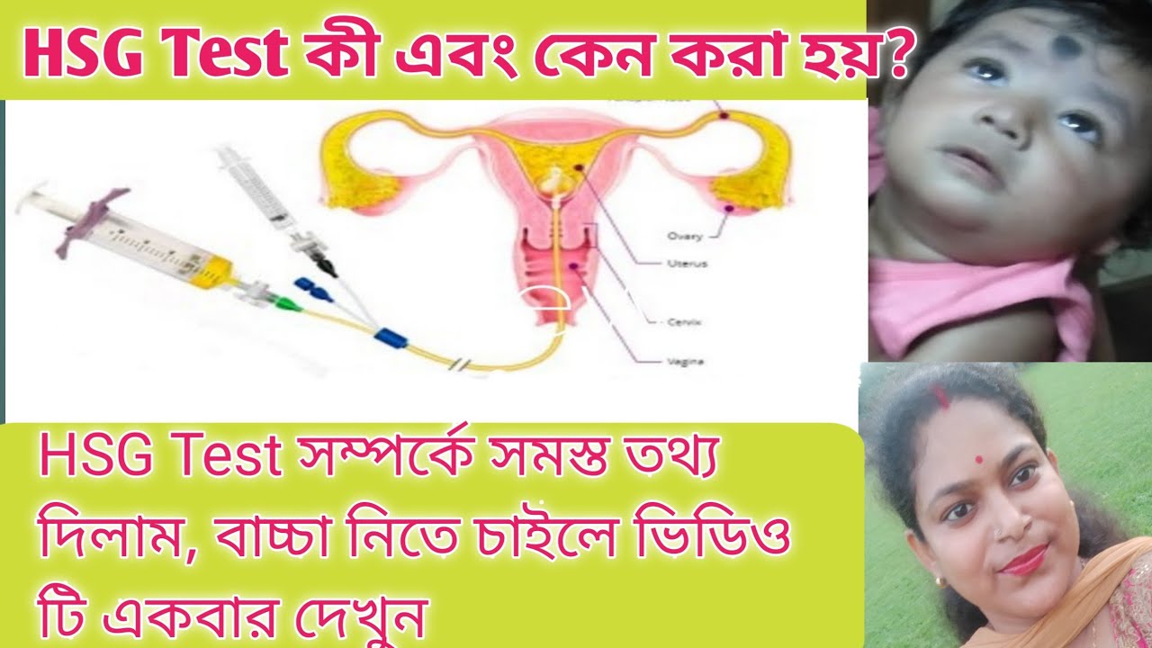 HSG(HSG) Hysterosalpingography কী এবং কেন করা হয়? #HSG# ...