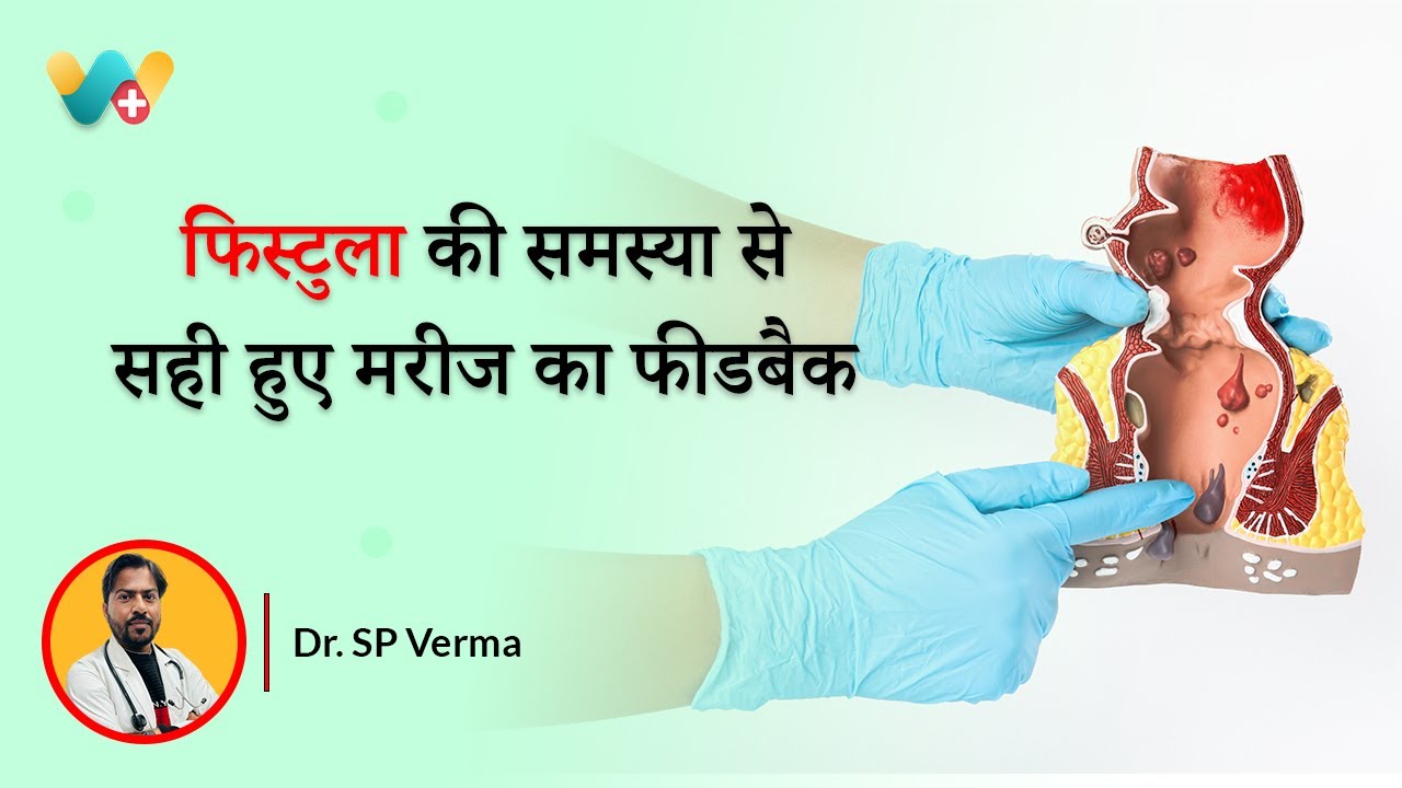 Fistula ka homeopathy Ilaj - Partha Dev Verma Ji ki Success Story | फिस्टुला का होमियोपैथी ...