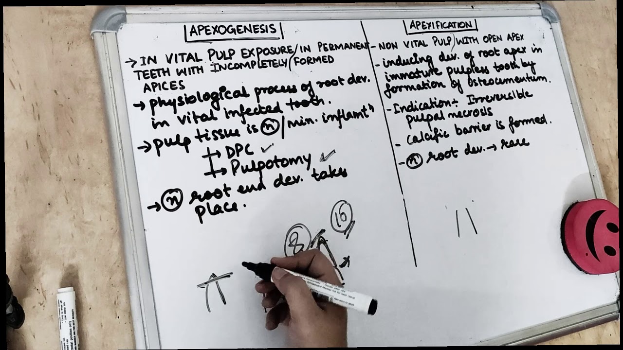 know difference between apexogenesis and apexification - YouTube