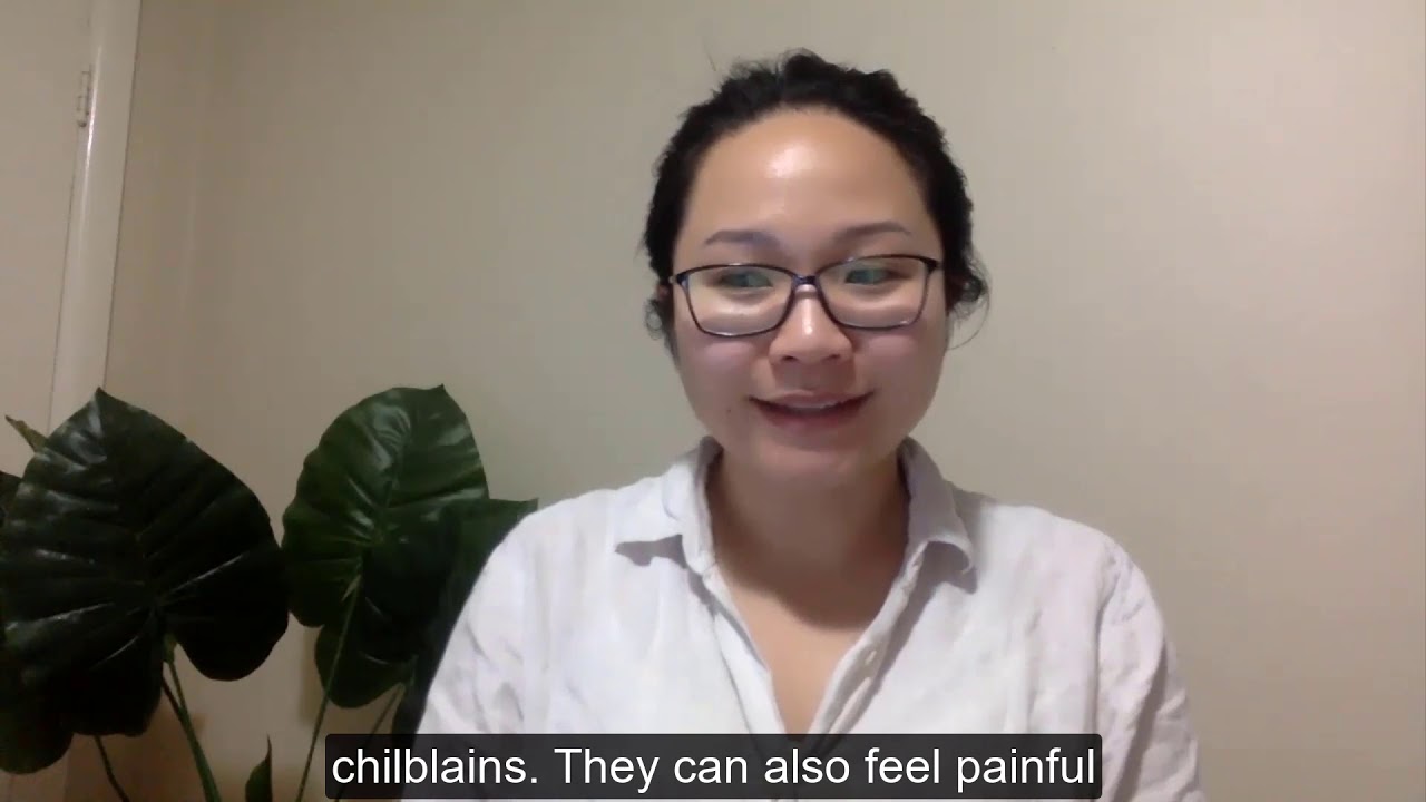 Chilblains - What they are and how to treat them - YouTube