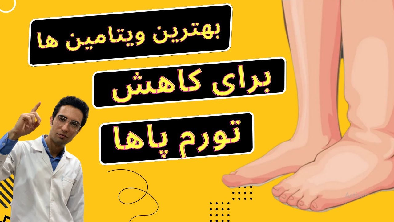تورم پا تورم مچ پا کاهش ورم پا درمان خانگی تورم پا تورم در پا نشانه چیست؟ ورم پا چیست
