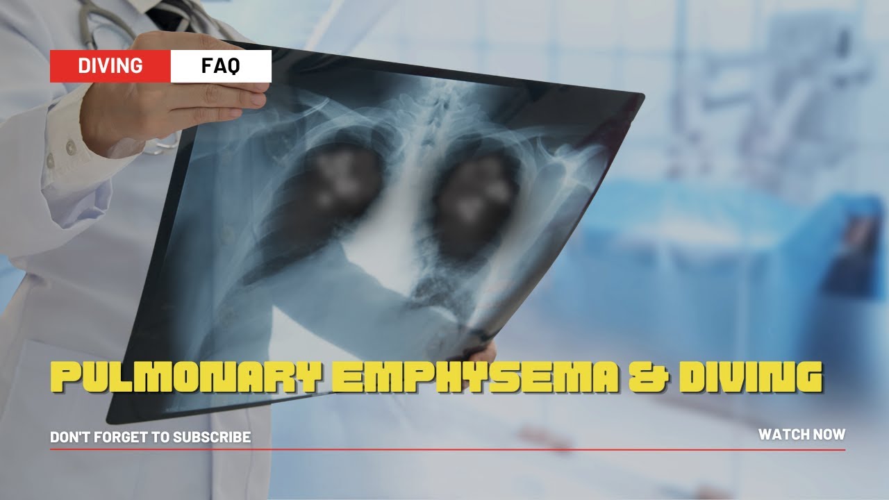 Pulmonary Emphysema & Diving - YouTube