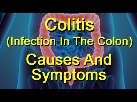 Colitis (Inflammation Of The Colon) Causes And Symptoms - YouTube
