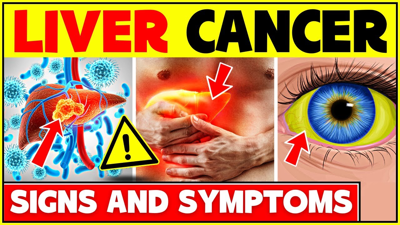 Early Signs And Symptoms Of Liver Cancer: Don't Ignore These Symptoms ...