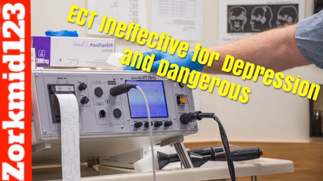 Electroconvulsive Thearpy ECT Doesn't Work For Depression & Should Be ...