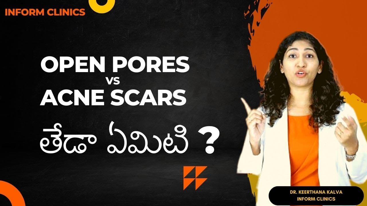 How to Identify the Difference Between Open Pores & Acne Scars? | Dr ...