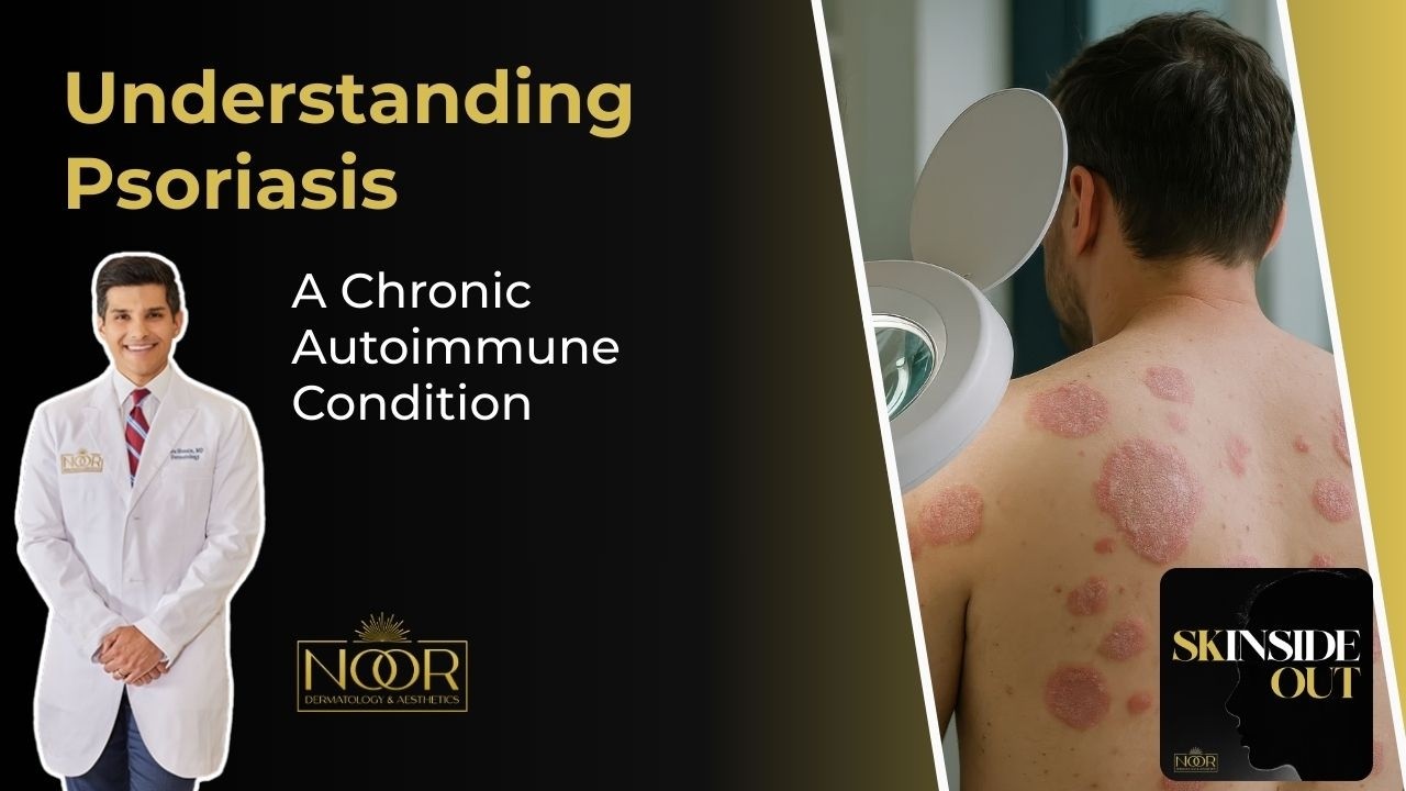Understanding Psoriasis: A Chronic Autoimmune Condition - YouTube
