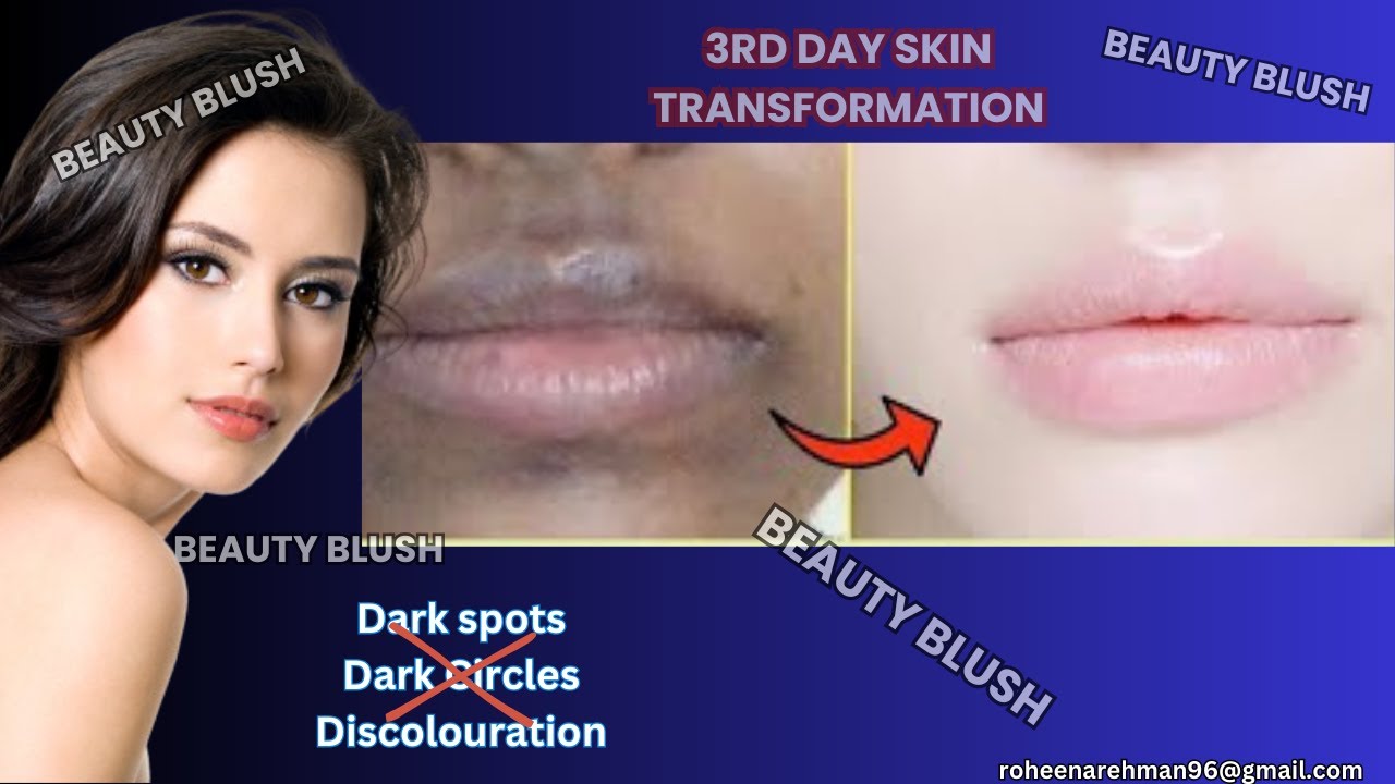 Day 3 Skin Transformation Challenge Remove Dark Spots, Dark Circles ...