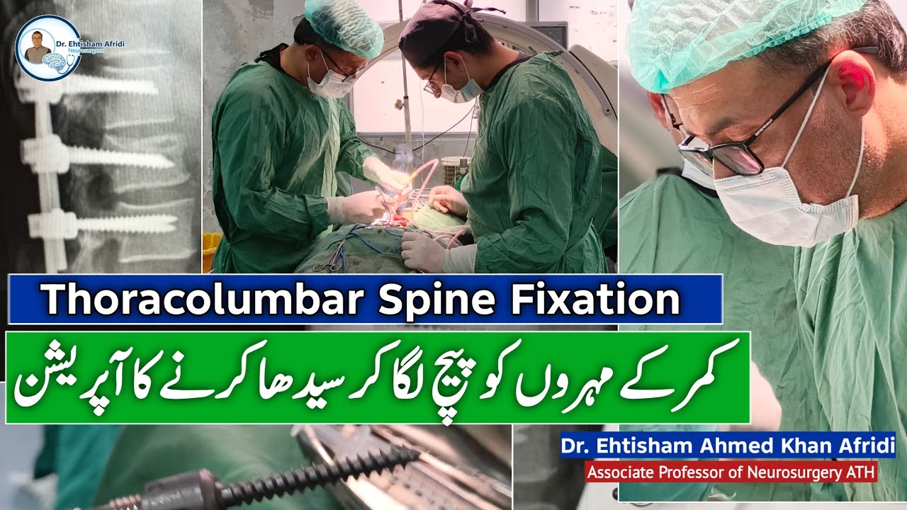 Severe Back Pain After Fall? Successful Thoracolumbar Spine Fixation ...