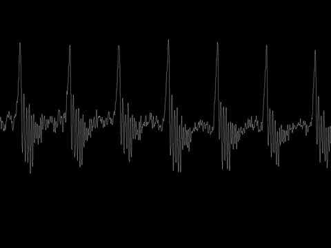 Suara kentut mencret bikin ngakak