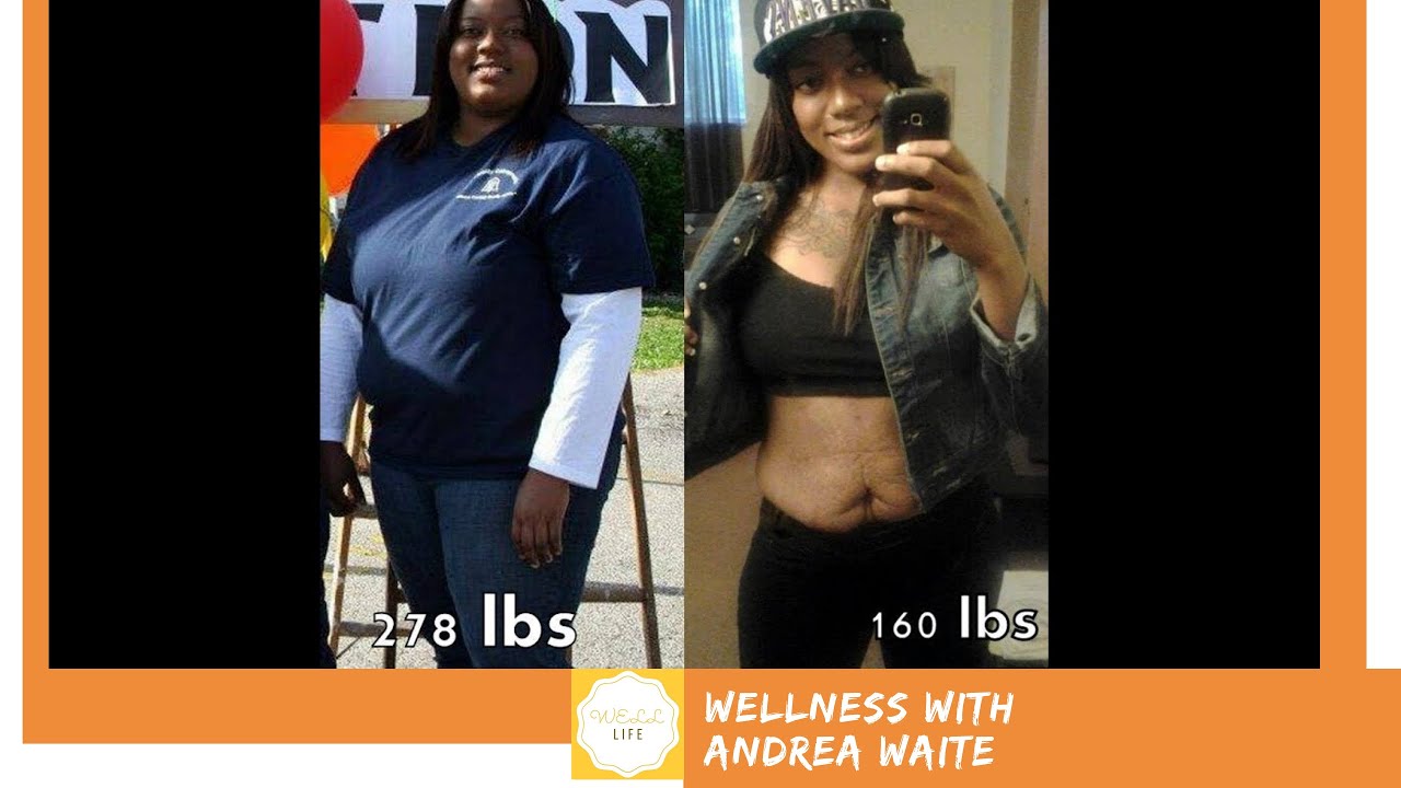 My 1 Year Weight Loss Anniversary Youtube