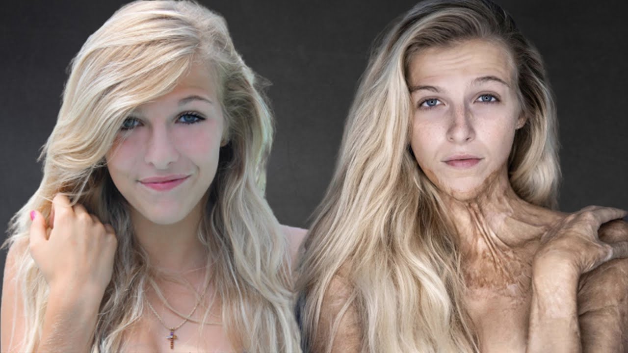 AVANT L'ACCIDENT : celle que j'étais - YouTube