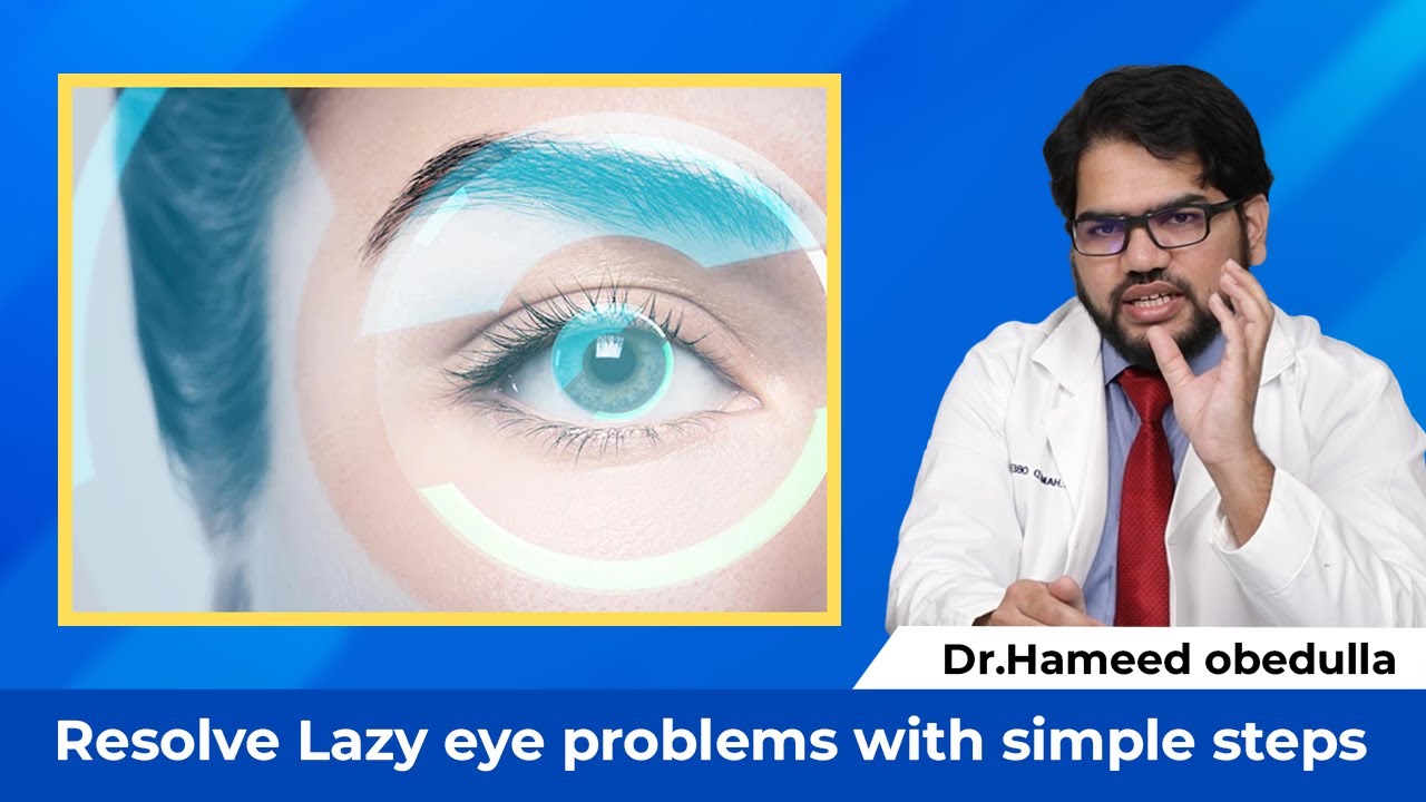 Lazy eye problems | Common Eye Conditions | The Eye Foundation | # ...