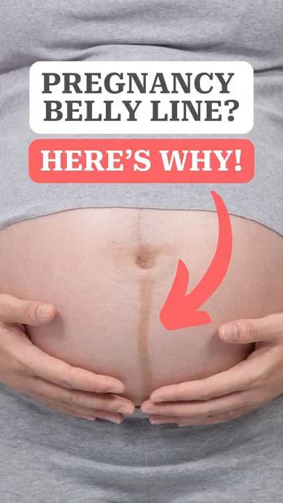 What’s That Dark Line on Your Pregnant Belly? - YouTube