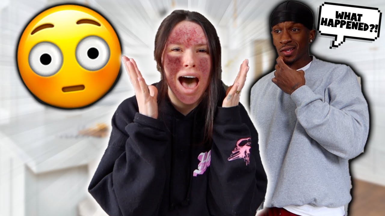 WHAT HAPPENED TO YOUR FACE?! - YouTube