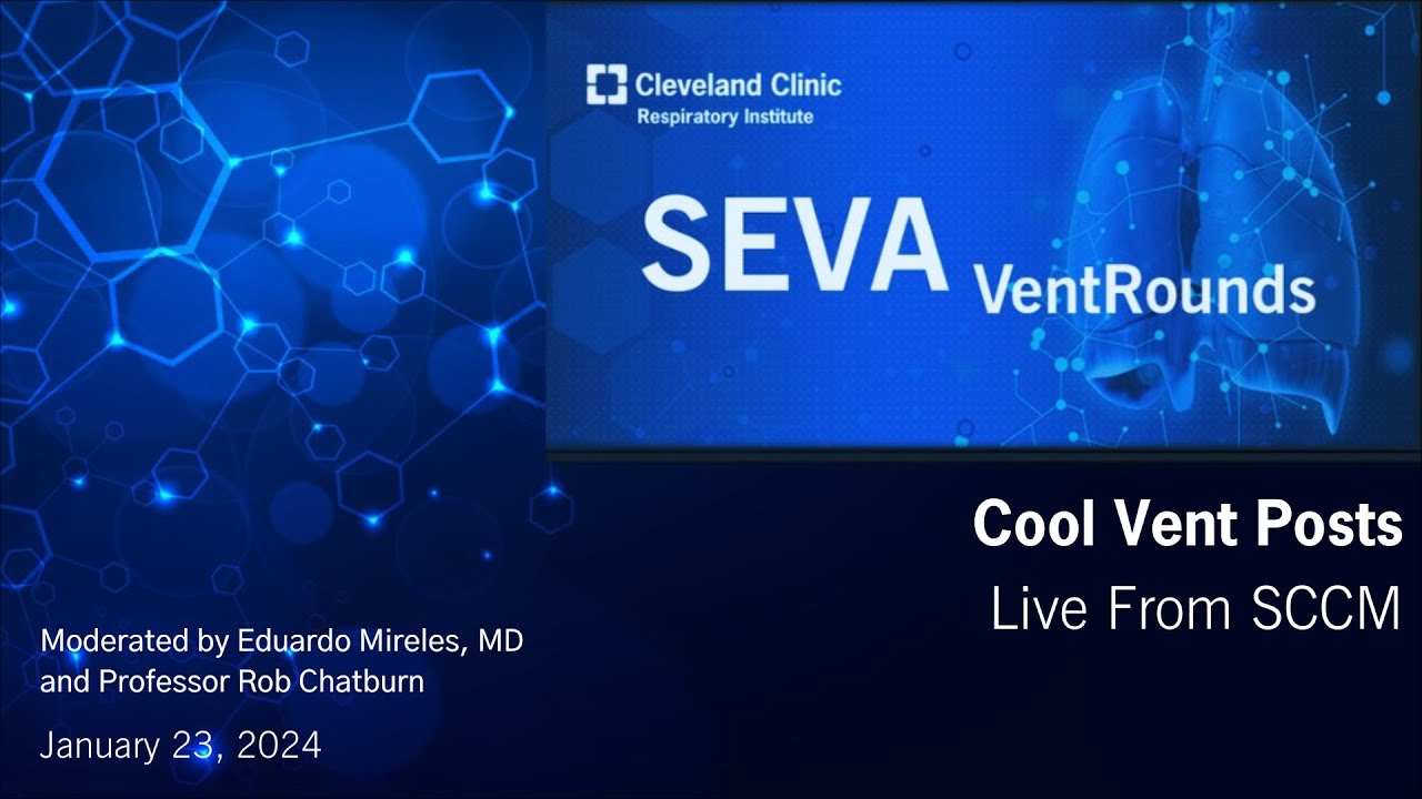 SEVA VentRounds Express: Cool Vent Posts From Social Media - YouTube