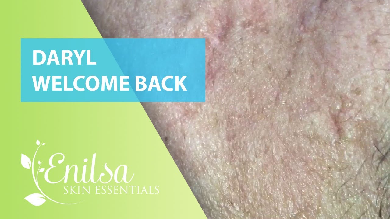 Welcome Back Daryl - YouTube