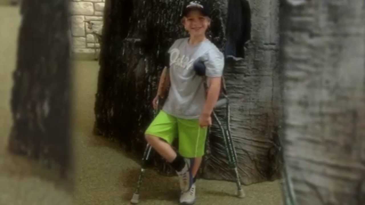Kolby's Perthes Story - YouTube