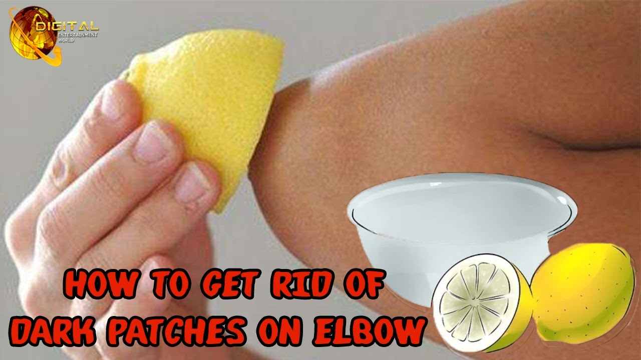 Beauty Tips | How To Get Rid Of Dark Patches On Elbows | Maya Khan ...