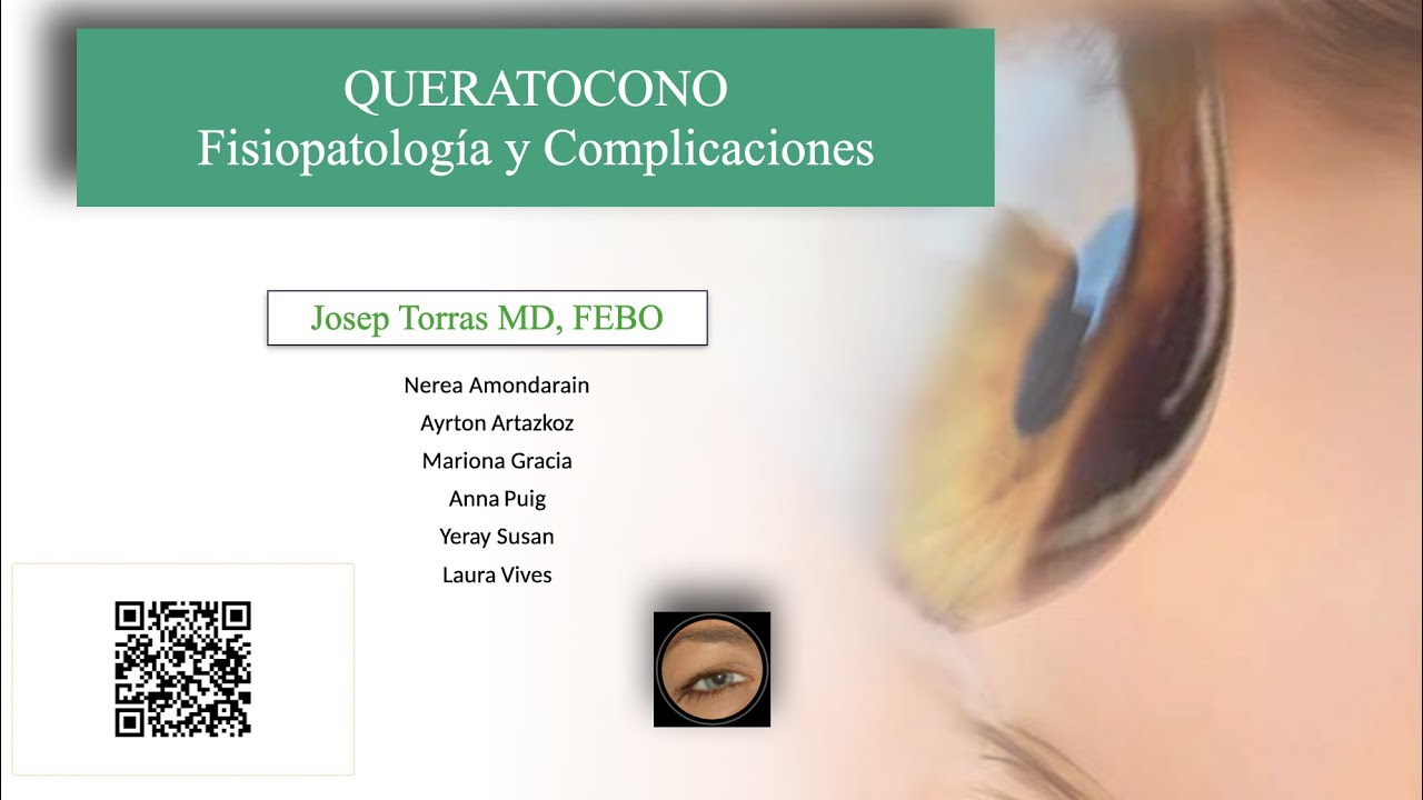 Queratocono. Fisiopatología y Complicaciones. - YouTube