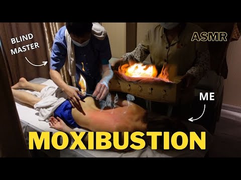 Kör Çinli Usta tarafından Moxa Tedavisi. ASMR