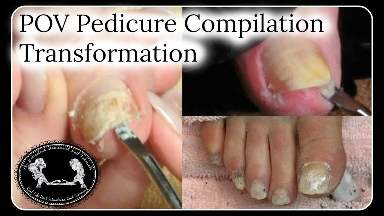 #4 POV Salon Pedicure Tutorial Toenail Transformation Compilation Big ...