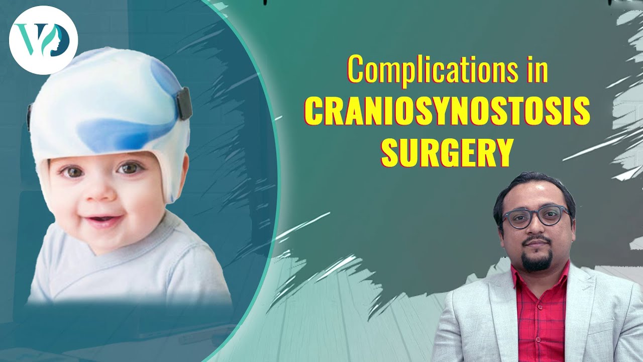Understanding the Risks: Complications in Craniosynostosis Surgery - Dr. Vybhav Deraje - YouTube