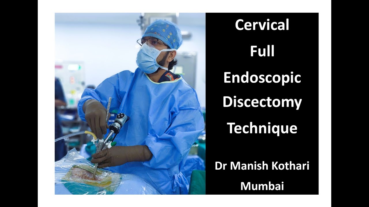 Full Endoscopic Cervical Discectomy / Monoportal / 5mm scope - YouTube