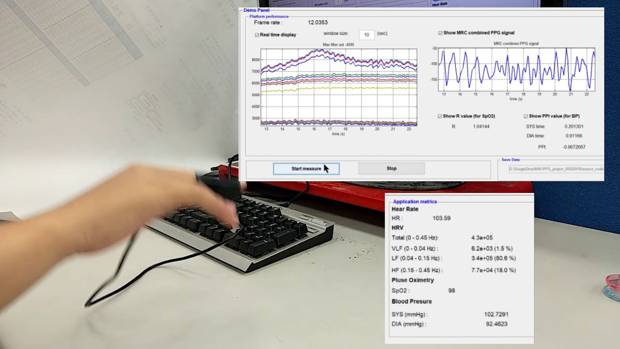 Stable vital signal measurement with hands shaking - YouTube