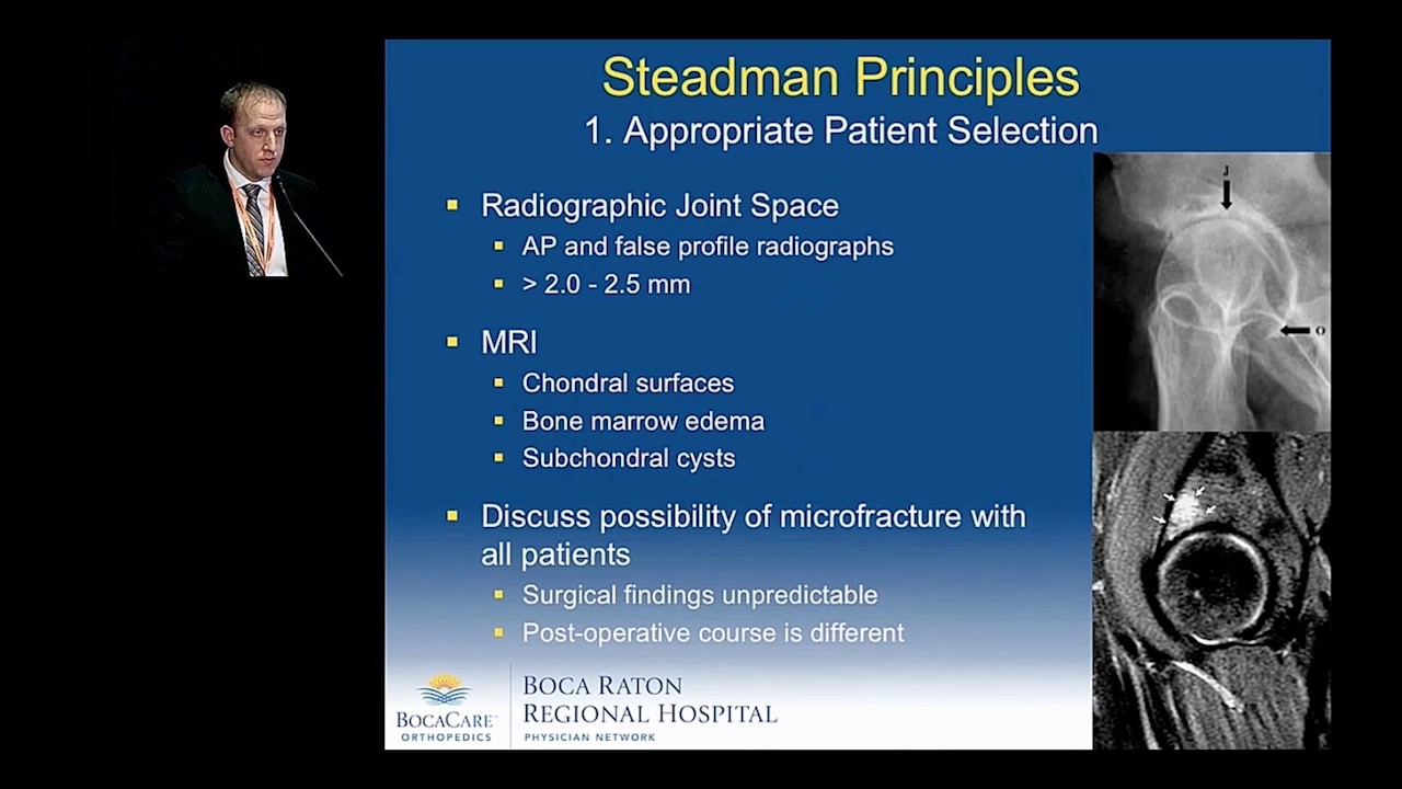 Microfracture of the Hip - YouTube