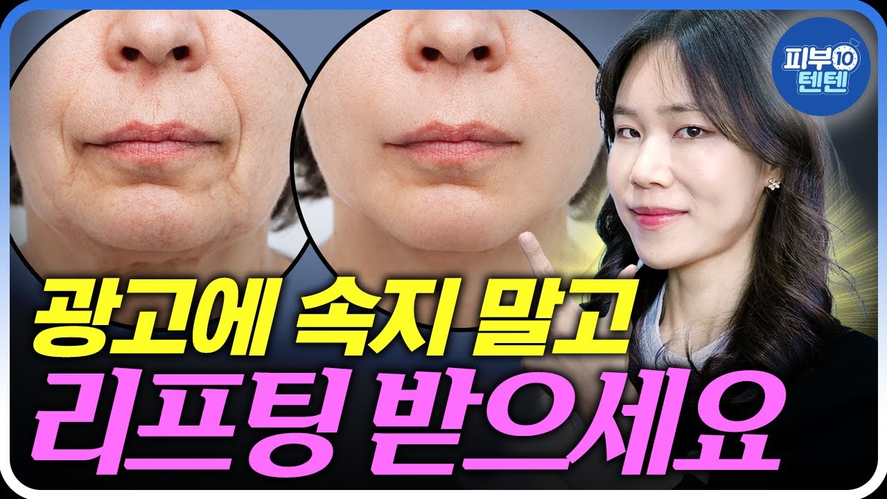 피부과의사가 받는 리프팅을 쫙 정리해봤습니다 울쎄라 써마지 올리지오 텐써마 슈링크 튠페이스 티타늄 리프팅 리프팅효과 후기