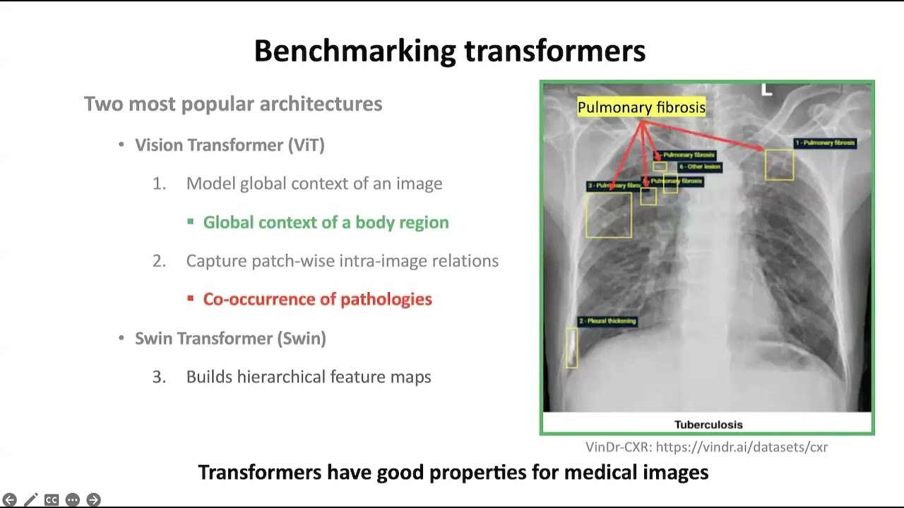 Benchmarking and Boosting Transformers for Medical Image Classification — MICCAI 2022-DART - YouTube