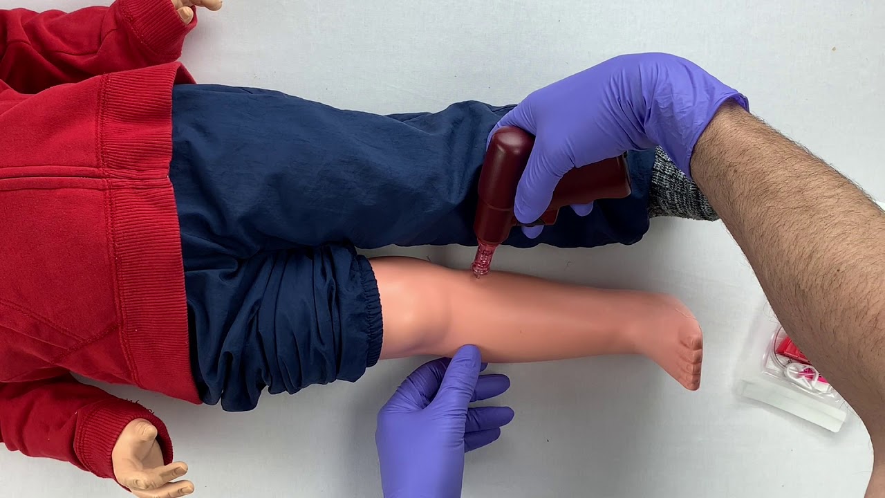Pediatric Intraosseous Insertion YouTube Pediatric Intraosseous Insertion YouTube