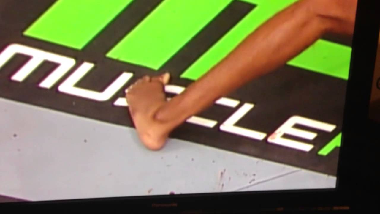 Jon Jones broken toe - YouTube