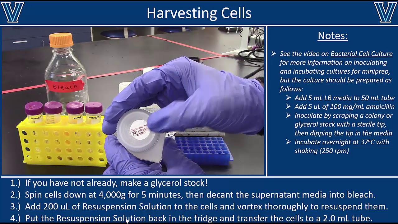 Miniprep Plasmid DNA Isolation YouTube miniprep-plasmid-dna-isolation-youtube