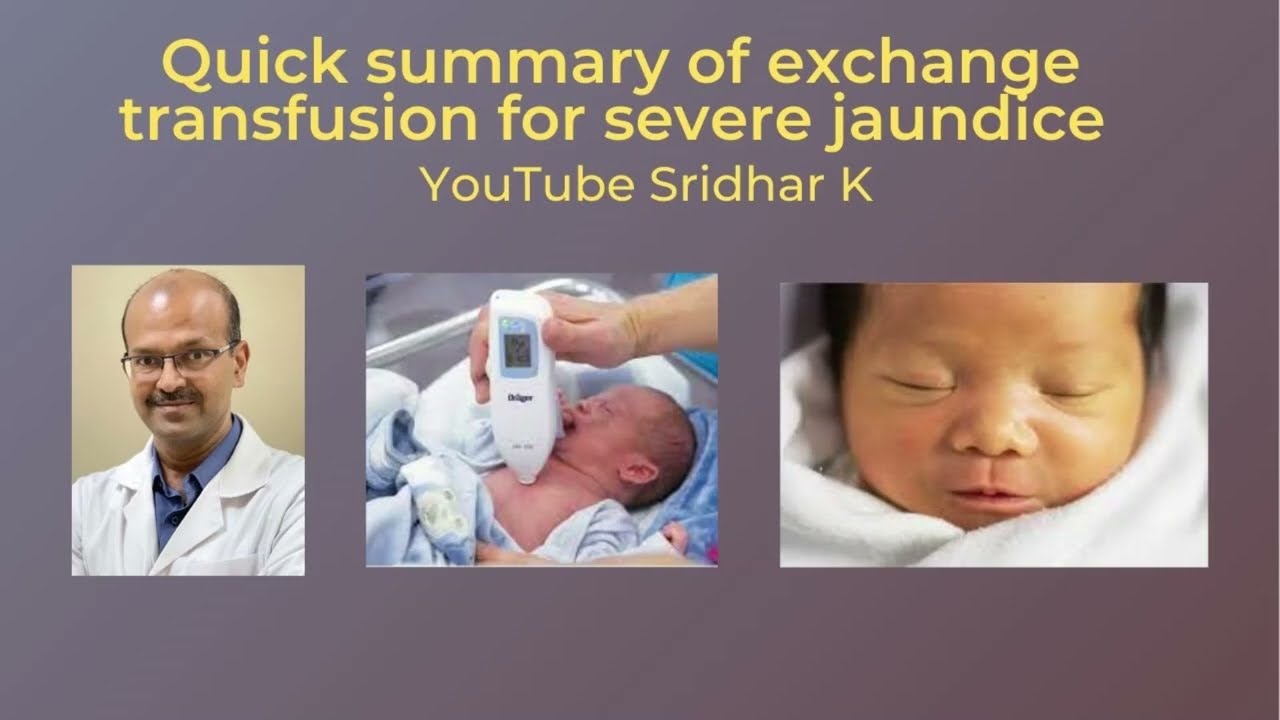 A quick overview of exchange transfusion for treatment of neonatal ...
