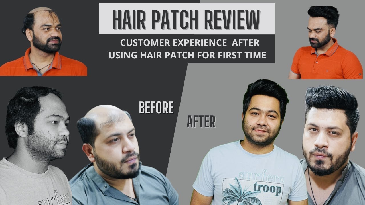 Hair patch Review | Feeling after getting hair patch for first time ...