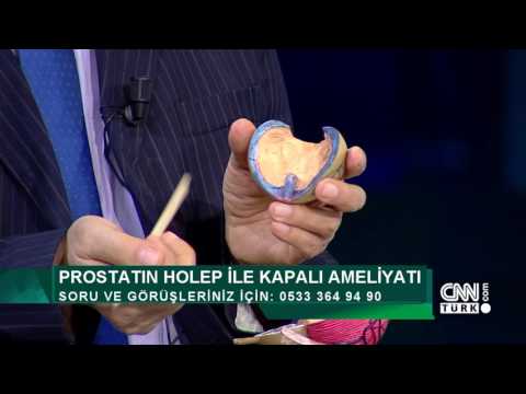 İyi Huylu Prostat Büyümesinde HoLEP Ameliyatı - Prof. Dr. Remzi Sağlam